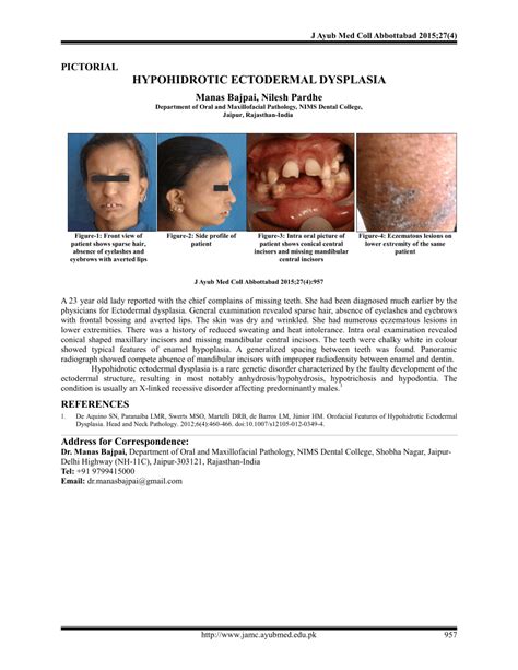 Pdf Hypohidrotic Ectodermal Dysplasia