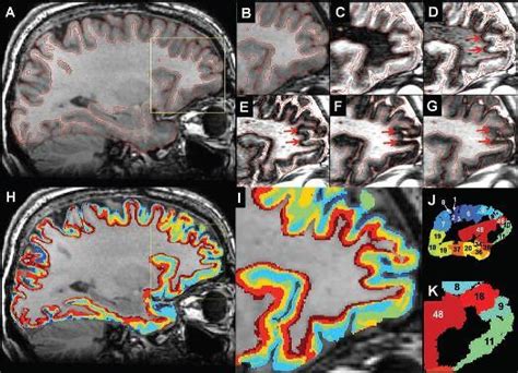 Whole Brain Visualization Of Distinct Cortical Layers By Mri