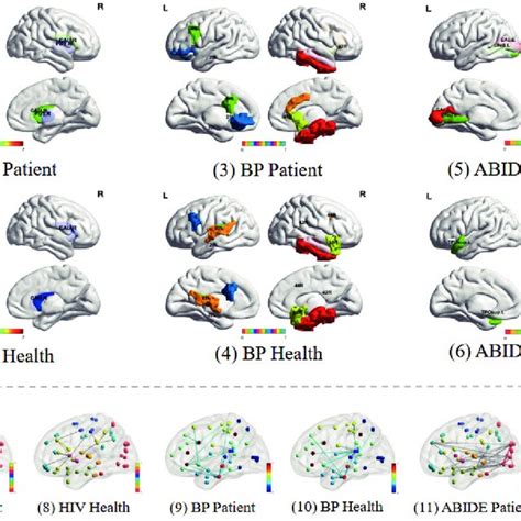 A Part Is Visualization Results Of Salient Brain Regions With