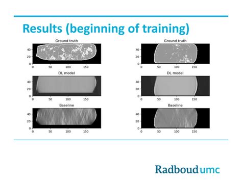 Inverse Problems In Medical Imaging PPTX