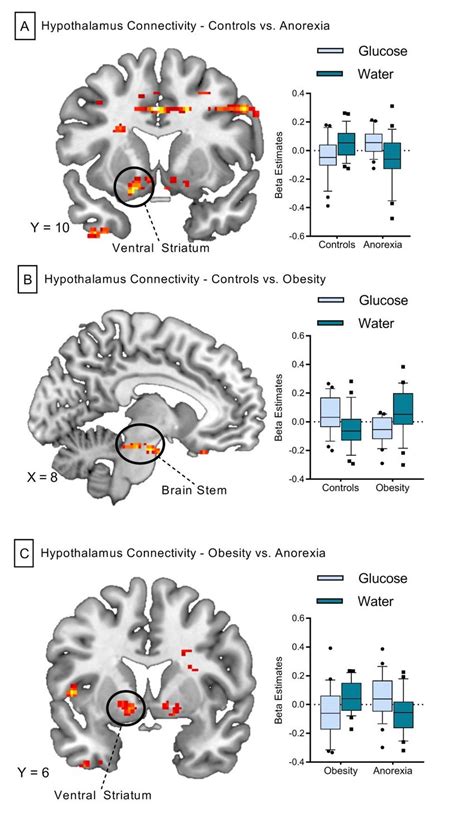 Satiety State Dependent Functional Connectivity Of The Hypothalamus