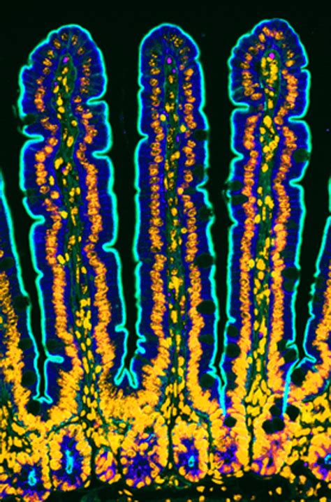 A Colorful Approach To Tracking Cellular Cargo The Scientist