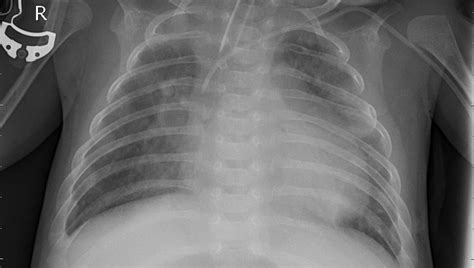 Medical X Rays Ct Dataset Object Detection Dataset And Pre Trained Model By Mrahmad Data