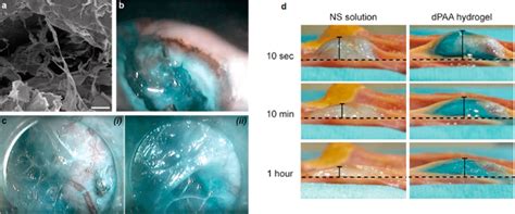 Sem Image Of The Explanted Tissue And Hydrogel Showing Collagen Fibers Download Scientific