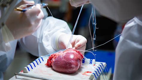 A Team Of Surgeons Are Practicing Artificial Heart Valve Replacement