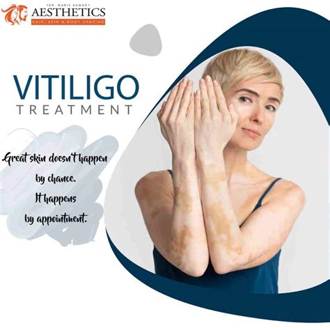 Vitiligo Treatment Dr Waris Anwar Aesthetics