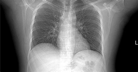 Ct Scan 4 Reddit Album On Imgur