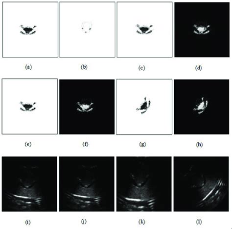 Us Mri Registration Based On The Other Methods Without Mmbs A Us Download Scientific Diagram Us Mri Registration Based On The Other Methods Without Mmbs A Us Download Scientific Diagram
