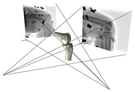 Integration Of Statistical Shape Modeling And Alternating Interpolation Based Model Tracking