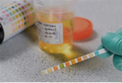 Colorectal Cancer Recognizing The Signs And Early Detection With The Ifobt Test Health