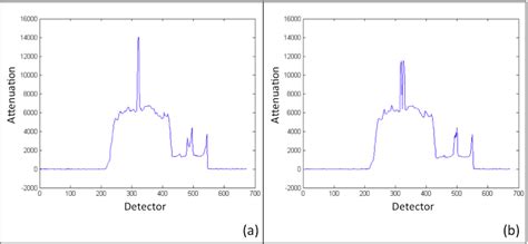 Figure 1 From Suppression Of The Ct Beam Hardening Streak Artifact Using Predictive Correction