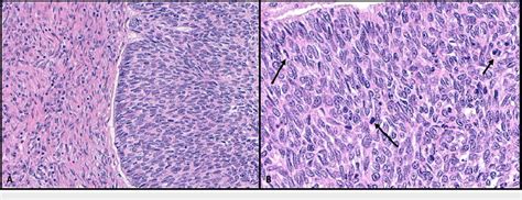 Histopathological Pattern Observed From Isolated Tumor Specimen A