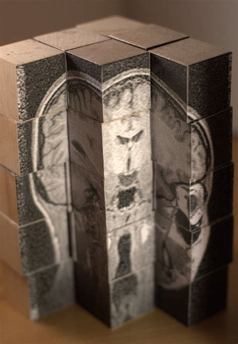 What Is Loreta On Eeg What Can I Use It For What Is Loreta On Eeg What Can I Use It For