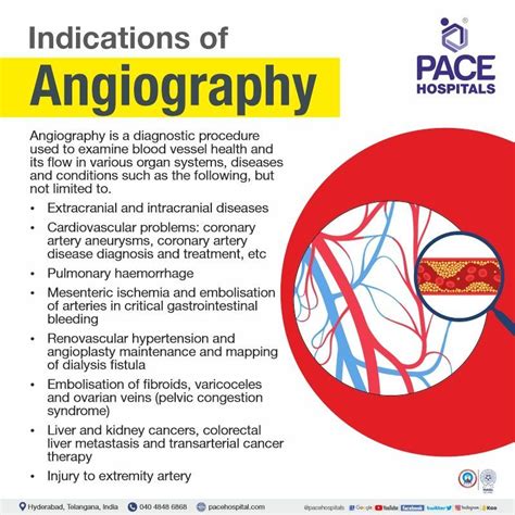 Angiogram In Hyderabad India Procedure Uses Cost And Side Effects