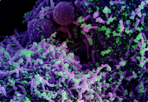Emerging SARS CoV Variant A Efficiently Evades Vaccine Induced Immunity