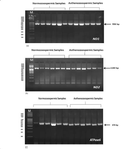 Pcr Products Lane M Lambda Dna Marker Digested With Restriction