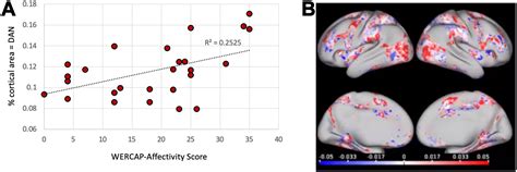 Size And Topography Of The Brains Functional Networks With Psychotic