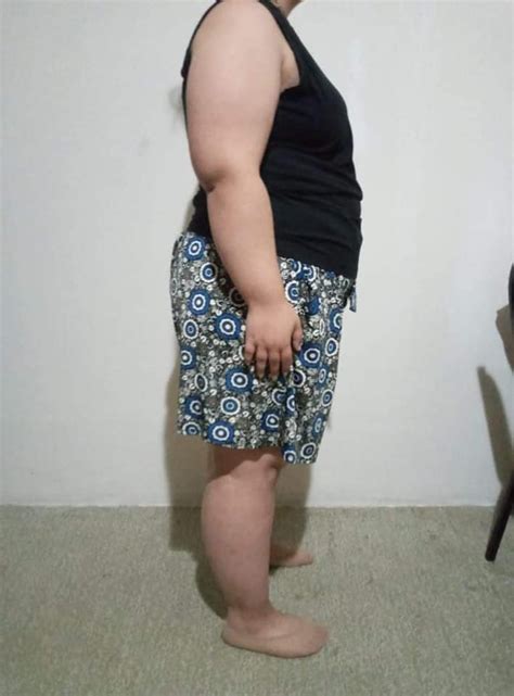 სწორი სწორი კვება ვარჯიში ენდოკრინოლოგი და დიეტოლოგი