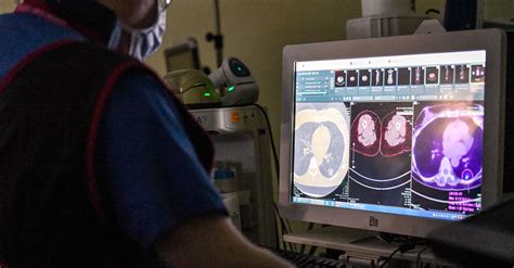 Lung Cancer Treatment And Follow Up Hackensack Meridian Health