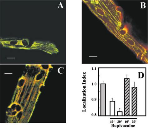 Effects Of Bupivacaine And Csa On Cytochrome C Distribution In Fdb Download Scientific Diagram