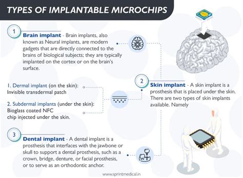 Implantable Microchips Types Advantages And Disadvantages Sprint