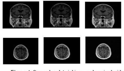 Table 1 From Mri Images De Noising Based In Dual Tree Complex Wavelet And Bayesian Map Estimator