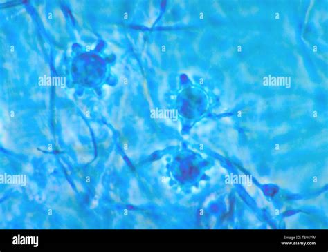 Photomicrograph Of The Multiple Macroconidia Of The Fungus Histoplasma