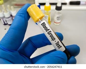 Negative Blood Grouping Images Stock Photos Vectors Shutterstock