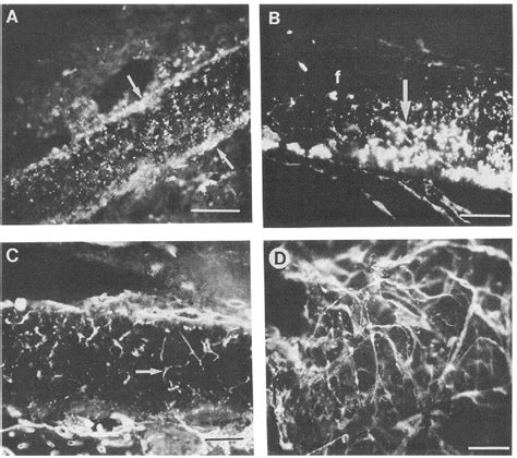 Neuron Projection Extension Involved In Neuron Projection Guidance