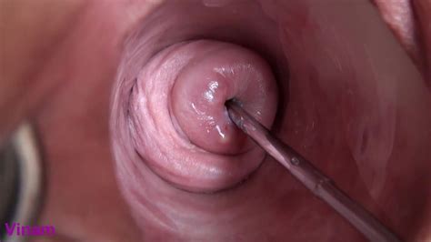 Doc Play Cervix Insertion