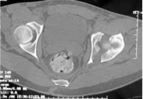 Question Qbank Orthobullets