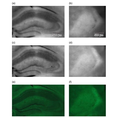 Pdf Wide Field Of View Lensless Fluorescence Imaging Device With Hybrid Bandpass Emission Filter