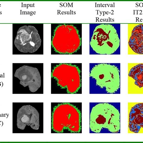 assessment of mr brain slice image segmentation algorithms using memory