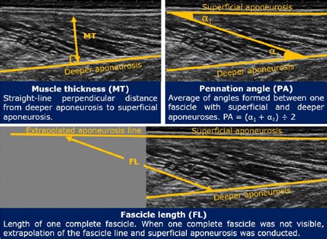 Muscle Architecture Variables Measured On Ultrasound Images Download Scientific Diagram