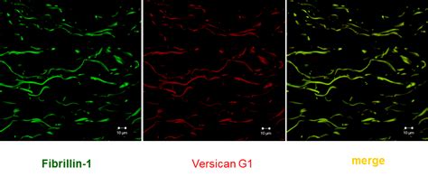 Viscoelastic Properties Of The Human Dermis And Other Connective