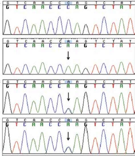 Electropherogram Of Partial Nucleotide Sequence Of The Exon 4 Of The