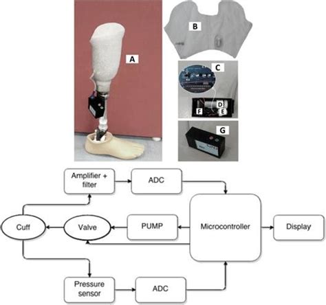 The Pirouzis Dynamic Socket For Transtibial Amputees B Prosthesis