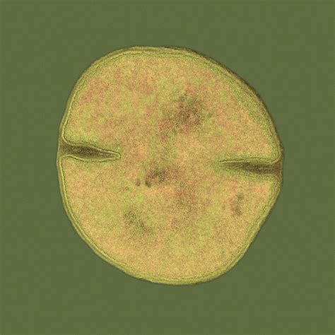 Staphylococcus Aureus Bacteria Tem Photograph By Science Stock