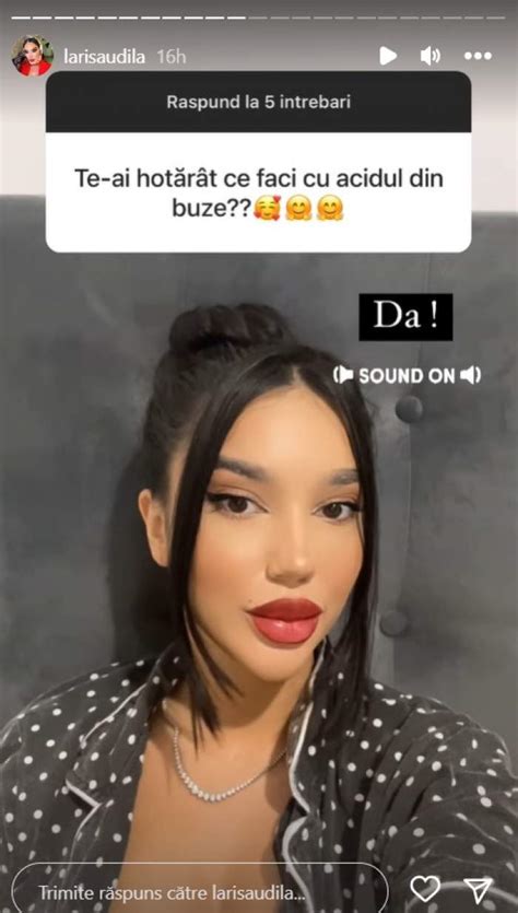 Larisa Udilă Regretă Intervenția Estetică La Buze Influencerița A Decis Să și Scoată Acidul