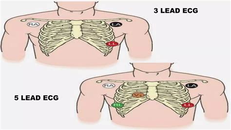 Hemodynamic Monitoring Non Invasive Pptx First Aid Injuries