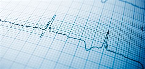Ai Technology Can Predict Heart Attacks University Of Oxford