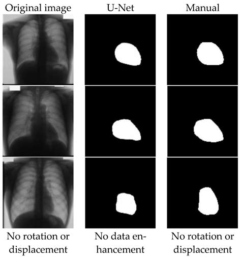 Applied Sciences Free Full Text A Segmentation Method Based On