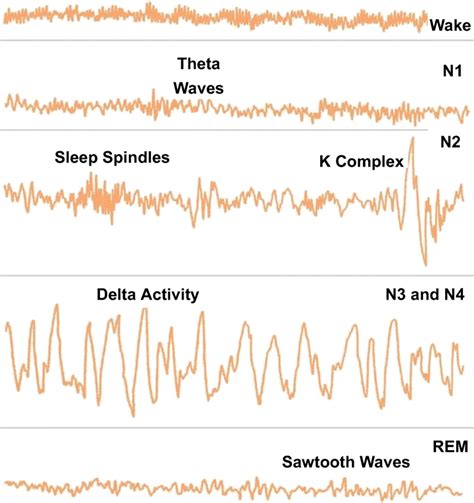 Specific EEG Characteristics Of Different Sleep Stages Download Scientific Diagram