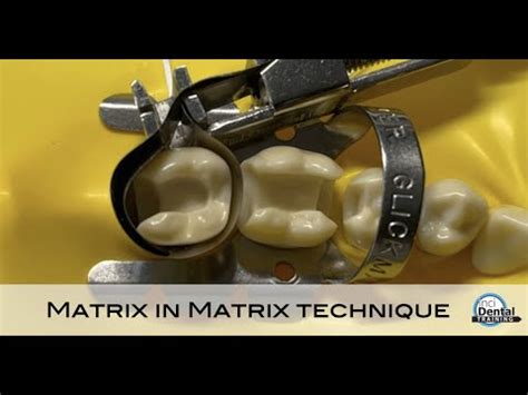 Matrix In Matrix Technique Video MEDtube Net