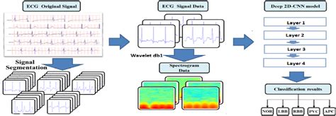 Figure 2 From Classification Of Ecg Arrhythmia Using A Convolution