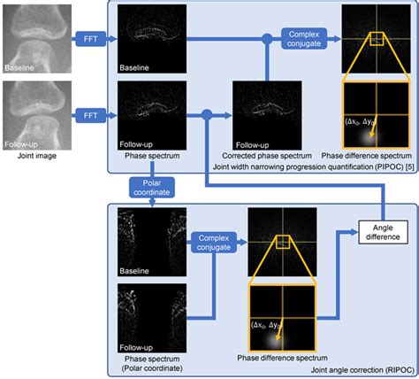 Joint Angle Correction In Rheumatoid Arthritis And Its Reliability