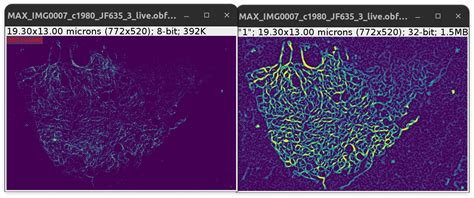 Strand Network Analysis Automated Reconstruction Image Analysis Imagesc Forum