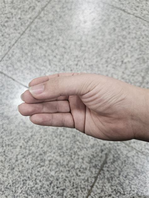 Fingerjointdetection2 Object Detection Dataset And Pre Trained Model