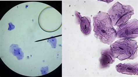 E Coli Under The Microscope Biology Notes Online