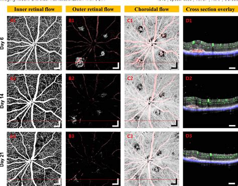 Figure 1 From Imaging Laser Induced Choroidal Neovascularization In The Rodent Retina Using
